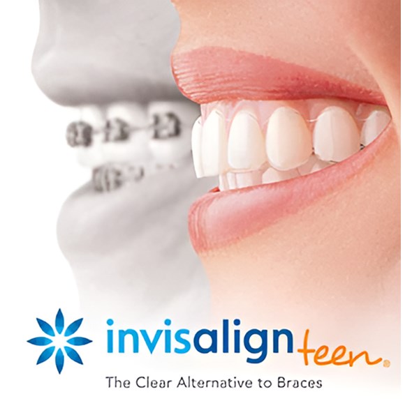 Invisalign for Teens: Clear Alternative | Mack Orthodontics